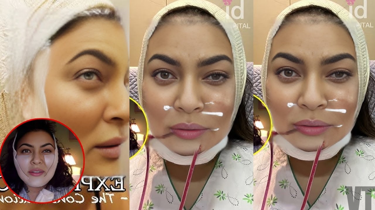 Sushmita Sen Looks Unrecognizable after Shocking Plastic Surgery, Chin ...